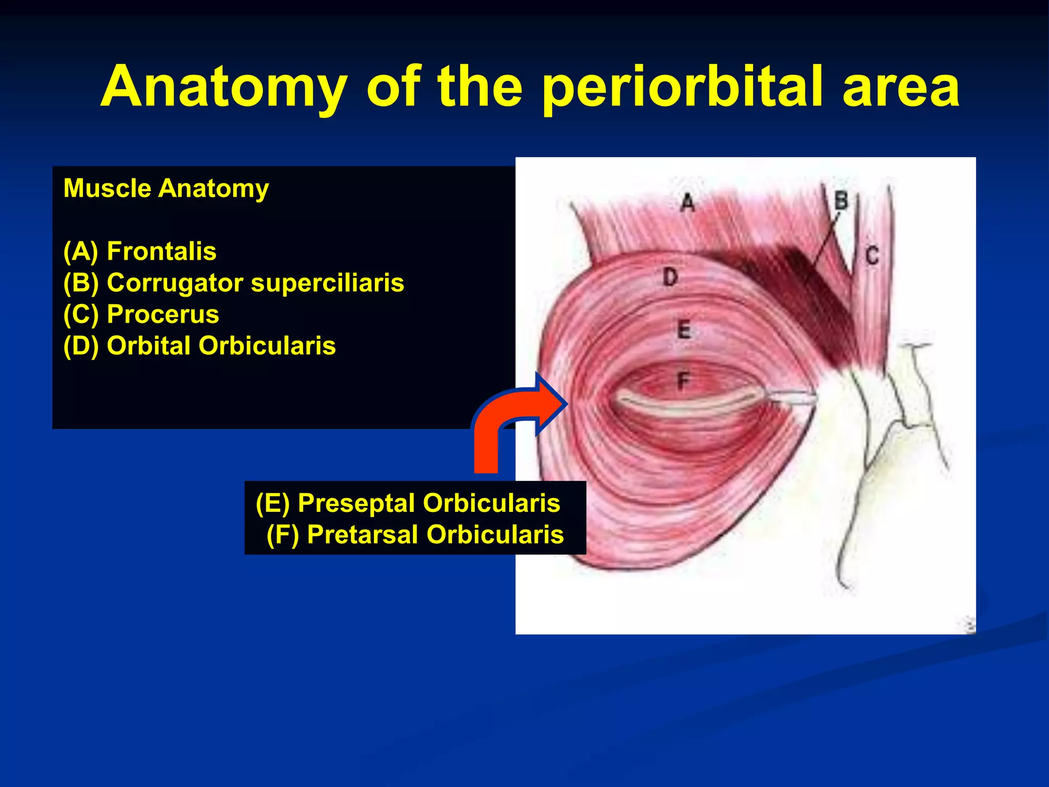 Using Botox for Periorbital Rejuvenation