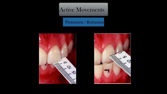 Manual Functional Analysis | PPT