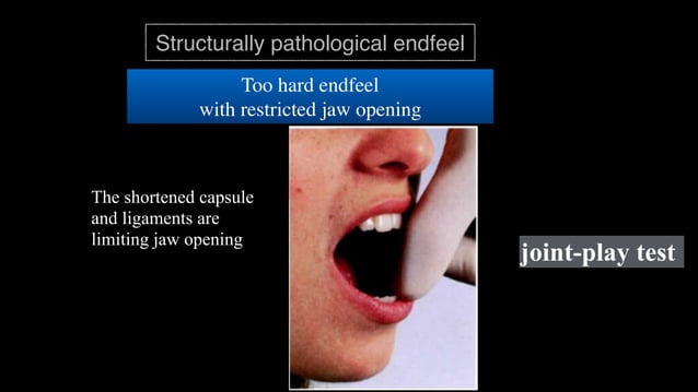 Manual Functional Analysis | PPT