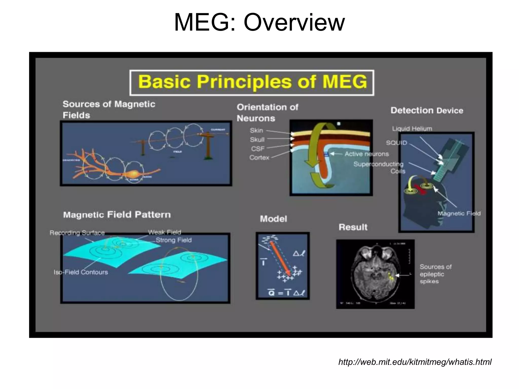 Basics of EEG | PPTX