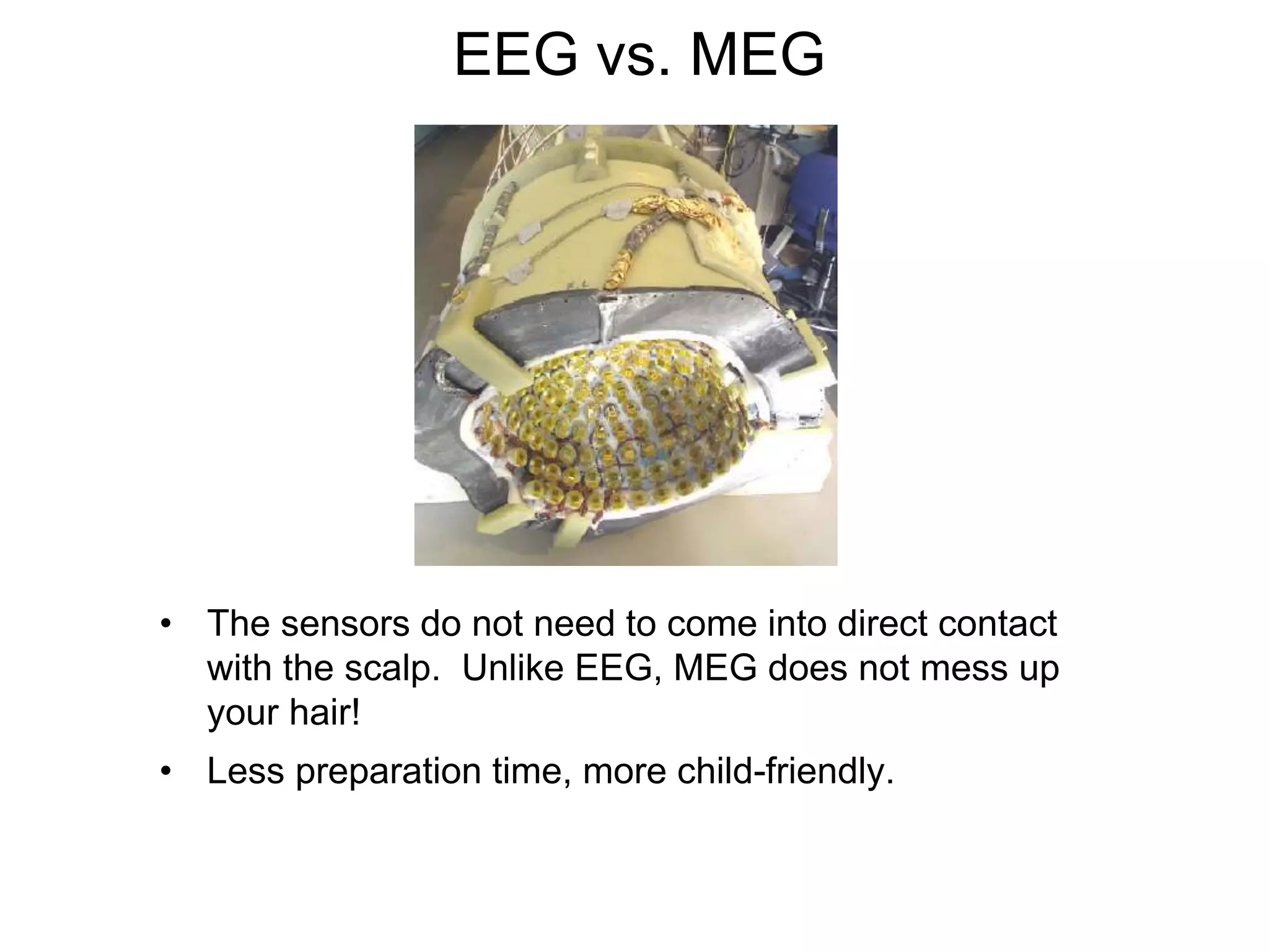 Basics of EEG | PPTX