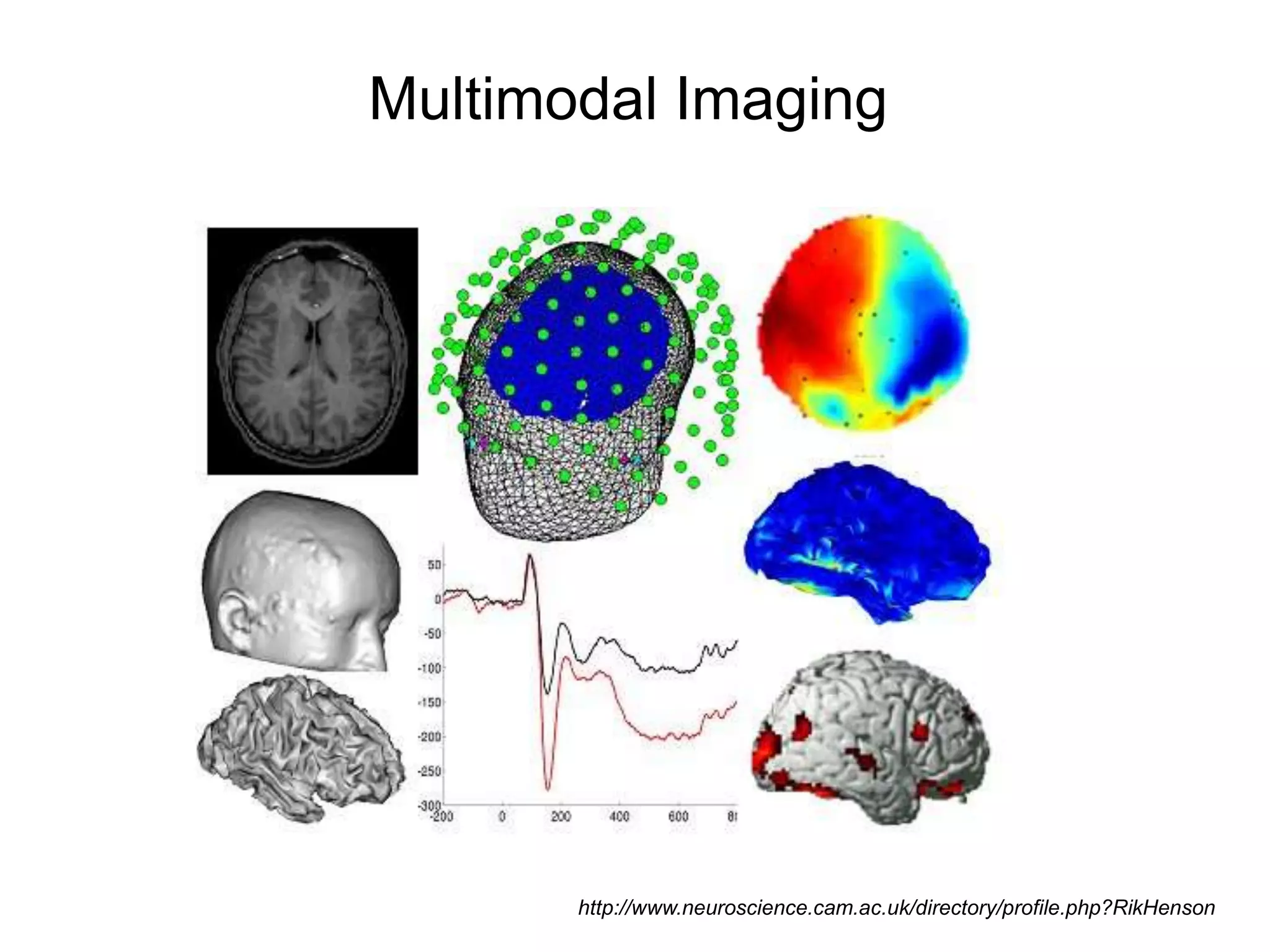 Basics of EEG | PPTX