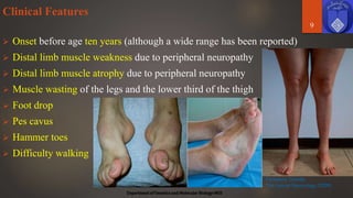 Mfn2 hereditary motor and sensory neuropathy | PPT