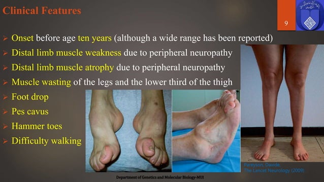 Mfn2 hereditary motor and sensory neuropathy | PPT