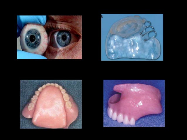 MAXILLOFACIAL PROSTHETIC MATERIALS (MFP MATERIALS) | PPTX