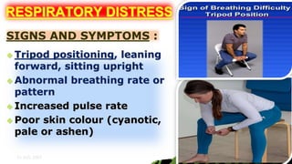 MEDICAL RESPIRATORARY EMERGENCIES | PPT