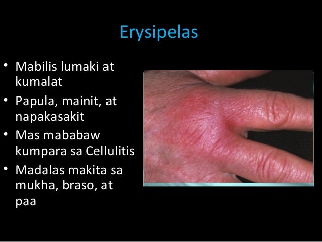 Mga sakit sa balat sanhi ng bacteria