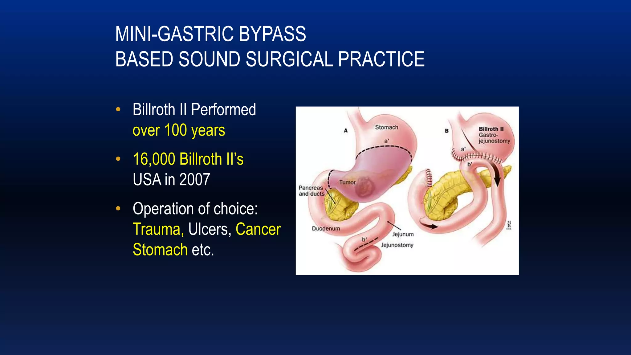 Mgb cancer & MGB Guidelines | PPTX