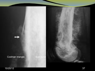 ROLE OF RADIATION IN BONE TUMORS FOR ORTHOPEDICS | PPT