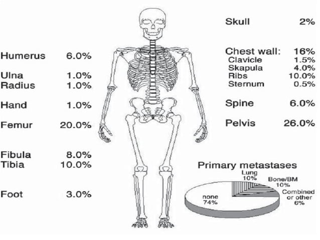 ROLE OF RADIATION IN BONE TUMORS FOR ORTHOPEDICS | PPT | Cancer ...