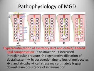 MGD...Unplugged | PPTX