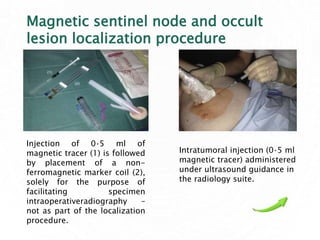 MAGNETIC GUIDANCE IN SURGERY | PPTX