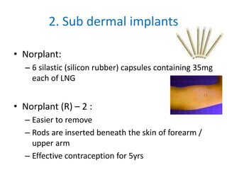 Mgm hormonal contraceptives | PPT