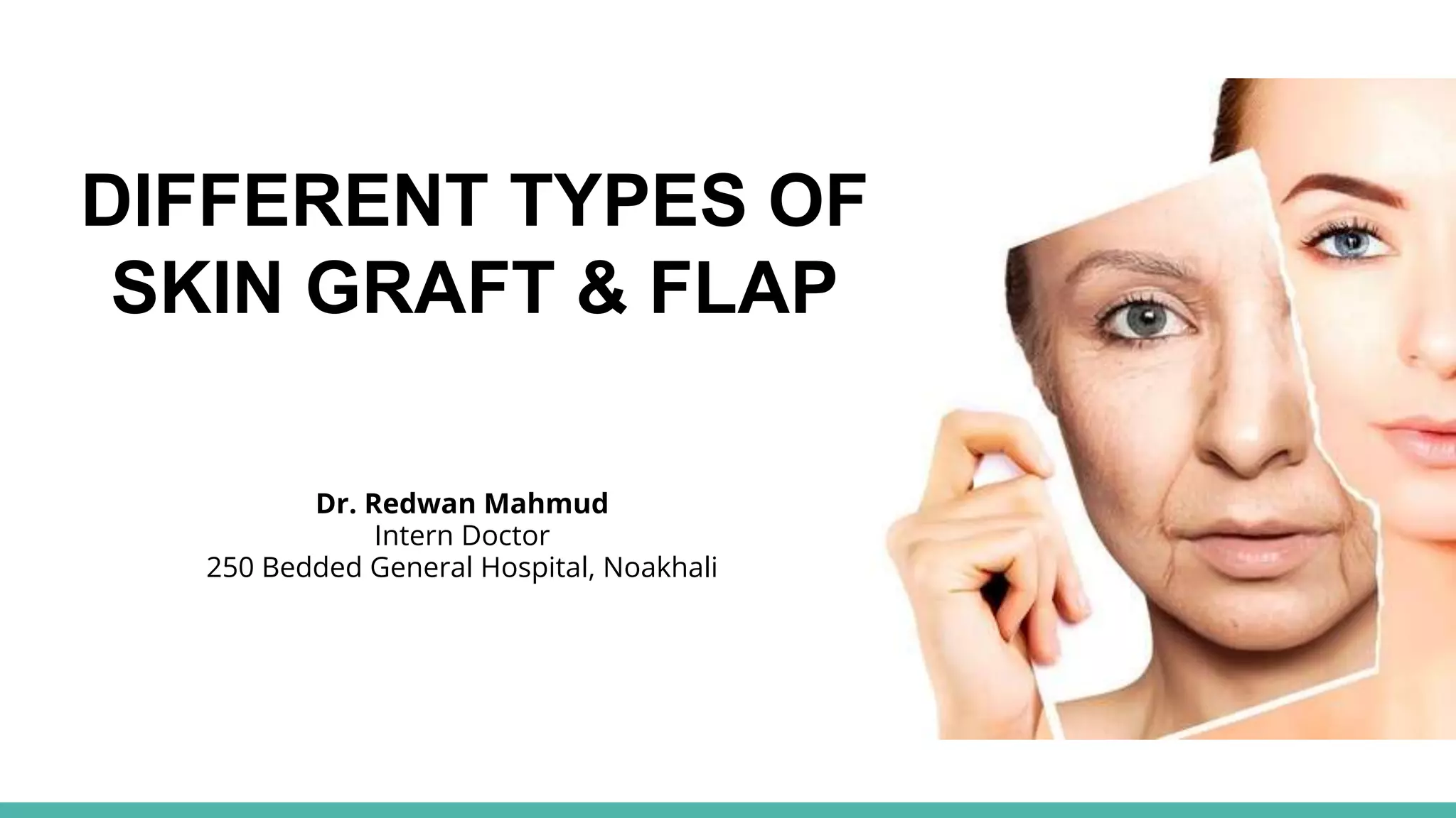 Different types of Skin graft & flap.pptx