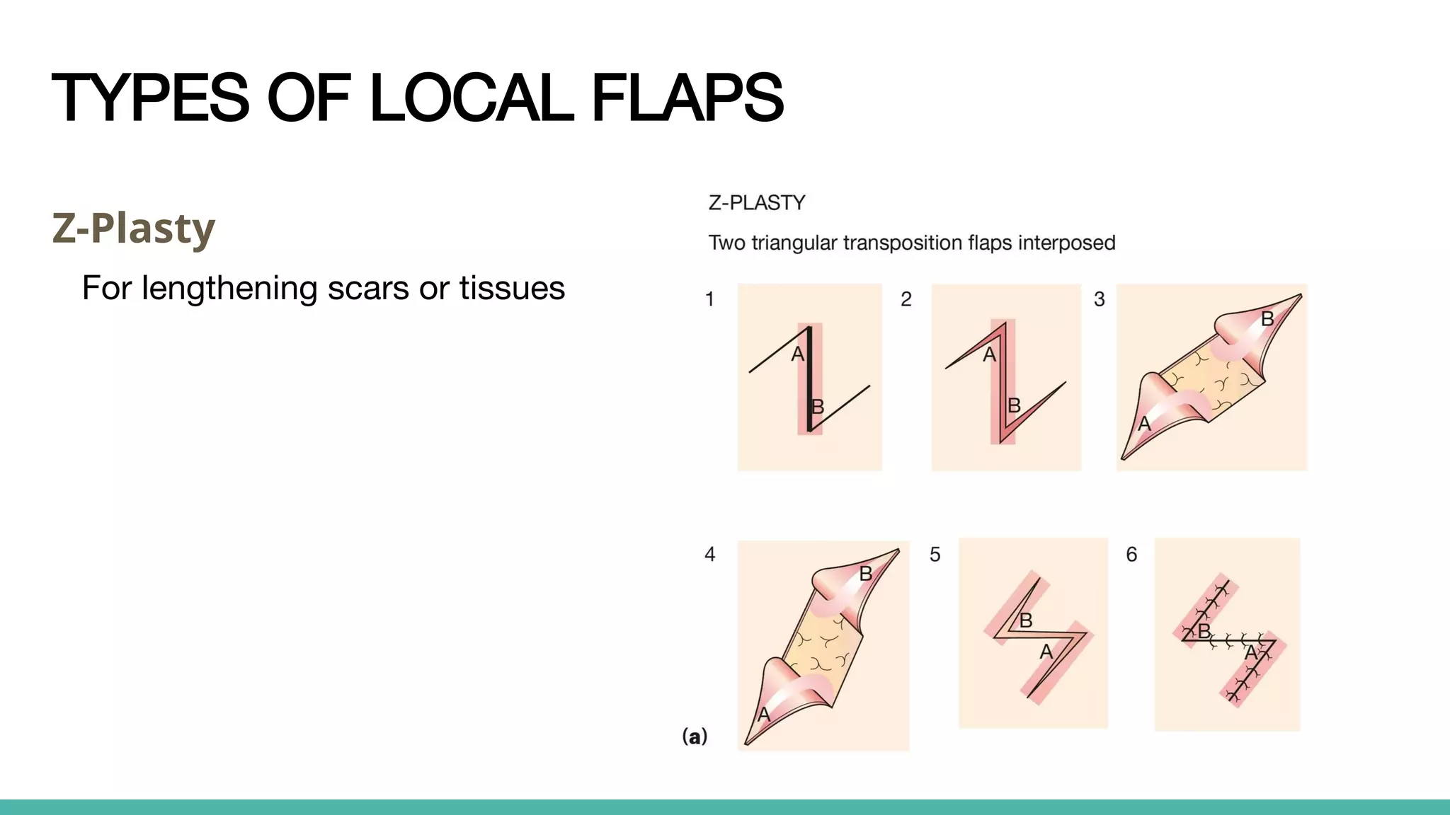 Different types of Skin graft & flap.pptx