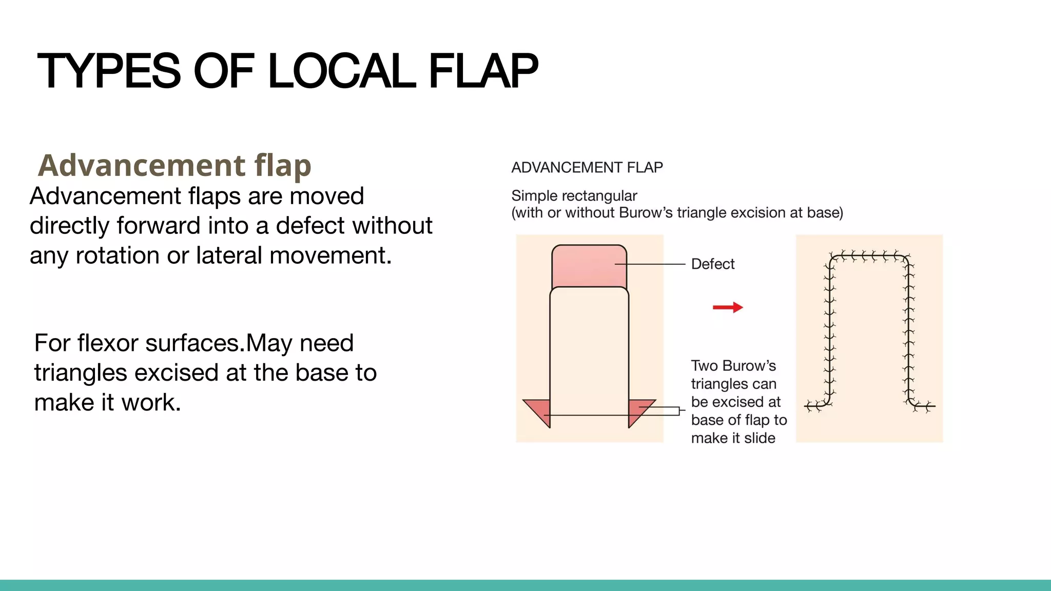 Different types of Skin graft & flap.pptx