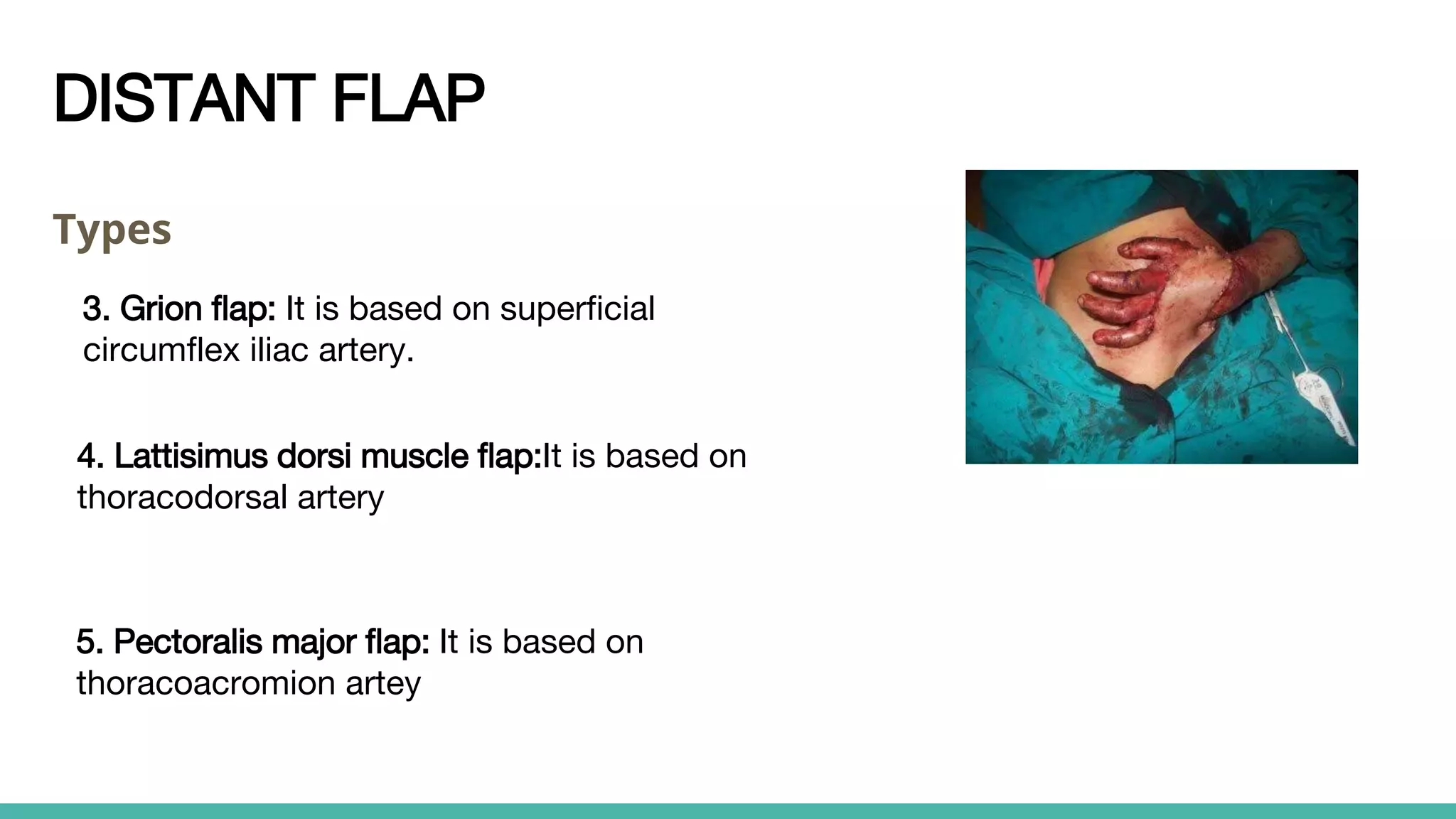 Different types of Skin graft & flap.pptx
