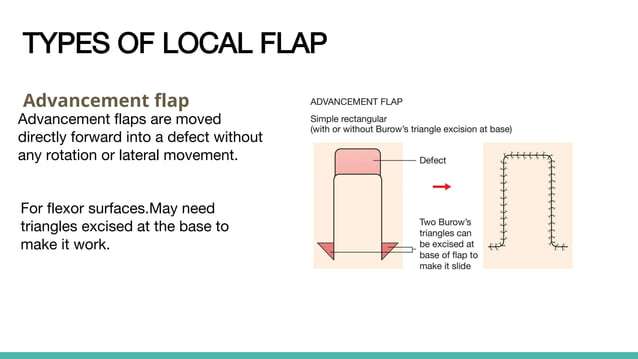 Different types of Skin graft & flap.pptx