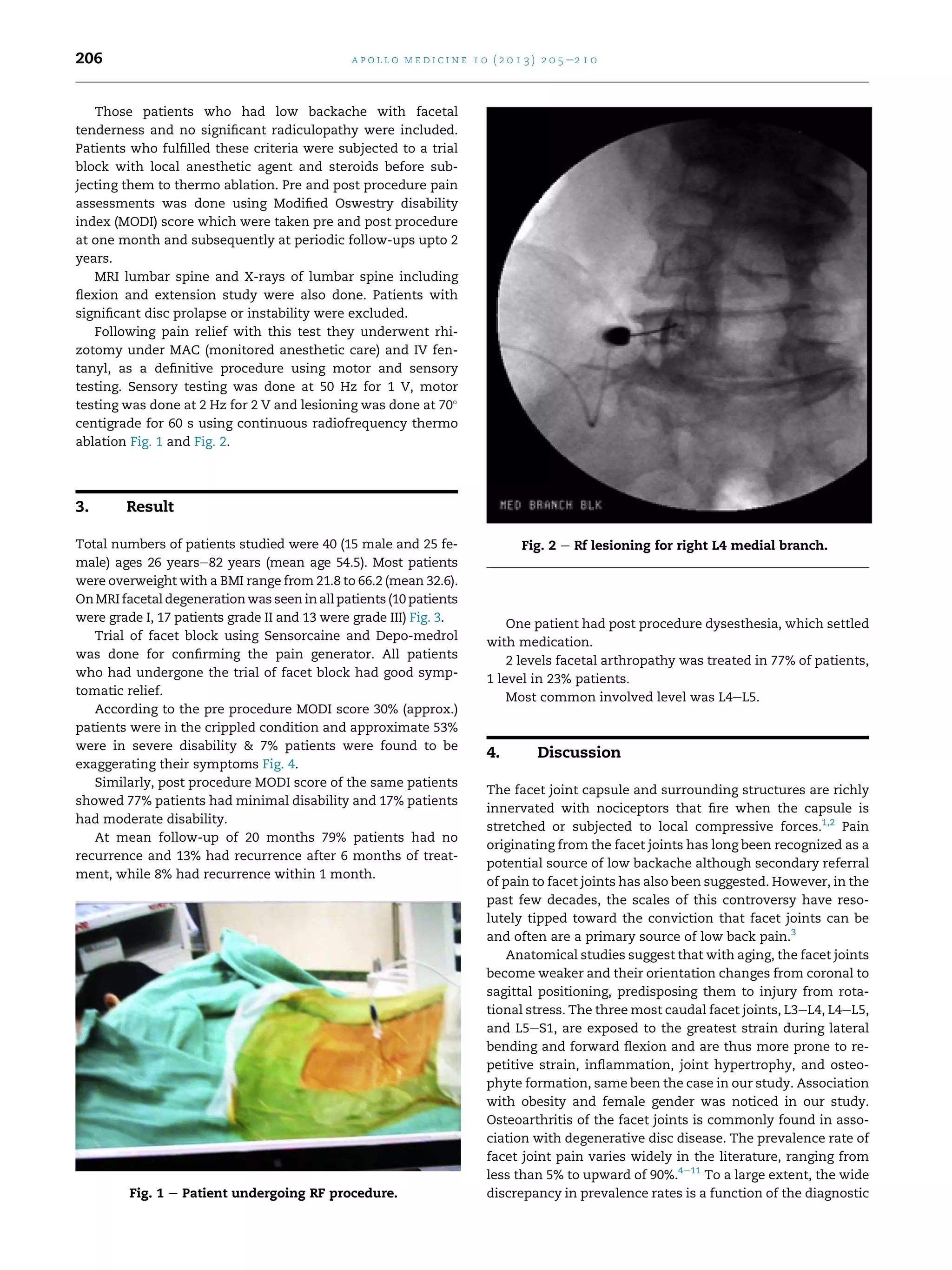 Management of Non Disco-genic low back pain: Our Experience of 40 Cases ...