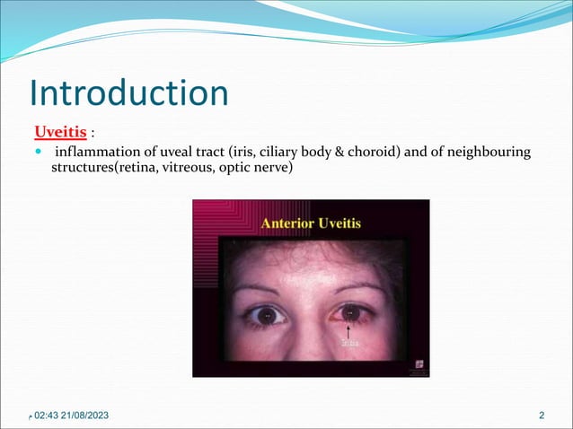lecture_on_anterior_uveitis_new.ppt