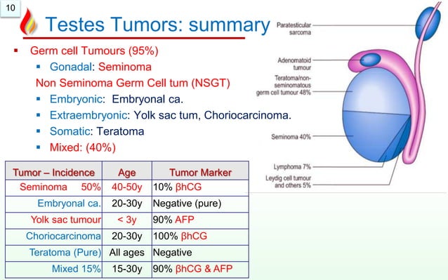 Pathology of Testes tumours | PPTX | Reproductive Health | Diseases and ...