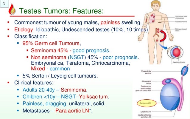 Pathology Of Testes Tumours