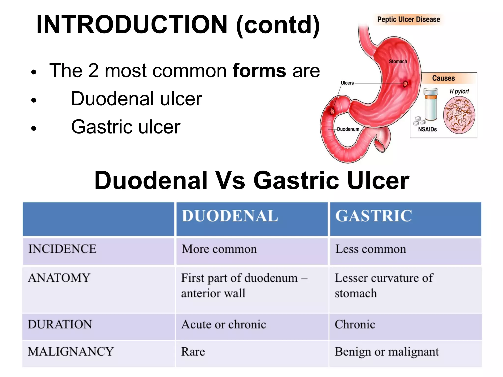 Management of Acute Exacerbation of Peptic Ulcer Disease (PUD) | PDF