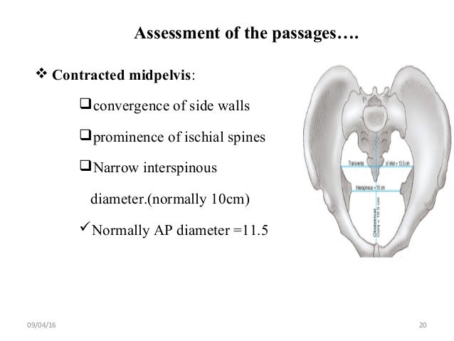 Management of abnormal labor & partograph