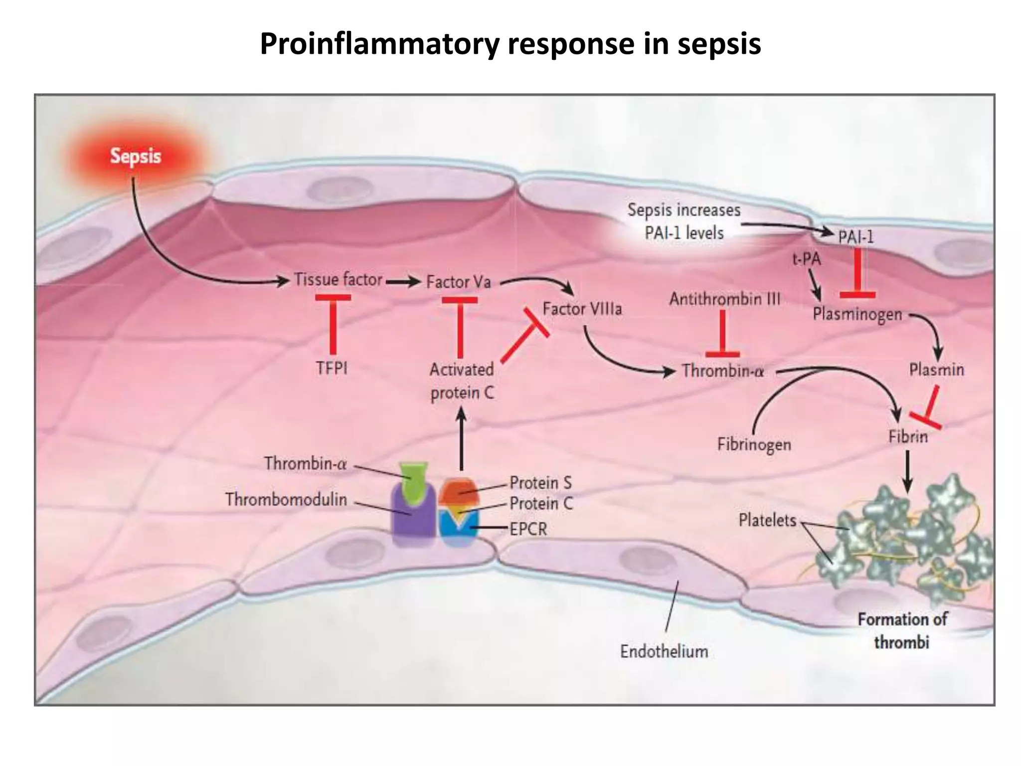 Management of sepsis | PPTX