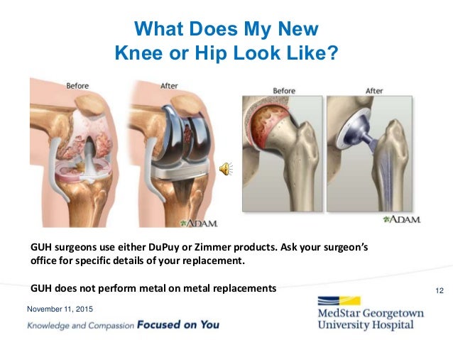 mguh-joint-replacement-class