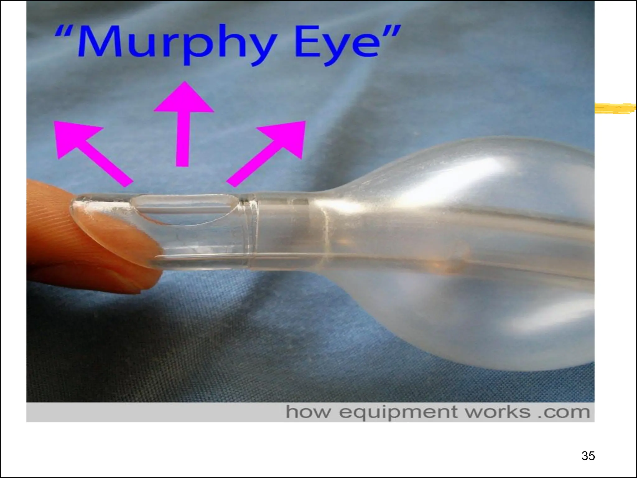 MHG1004-Lect 6-Assisting Dr in Definitive Airway Mx-intubation ...