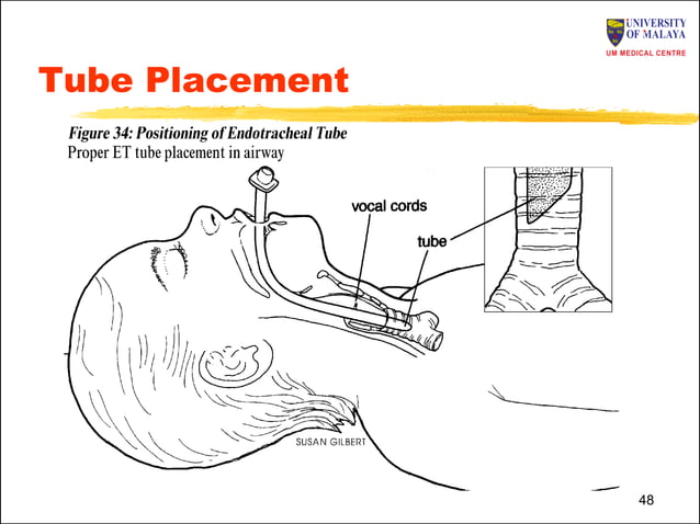 MHG1004-Lect 6-Assisting Dr in Definitive Airway Mx-intubation & extubation(8.8.2024).pdf