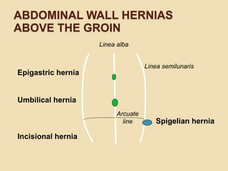 Linea Semilunaris Hernia