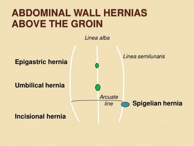 Hernias by MHR Corp