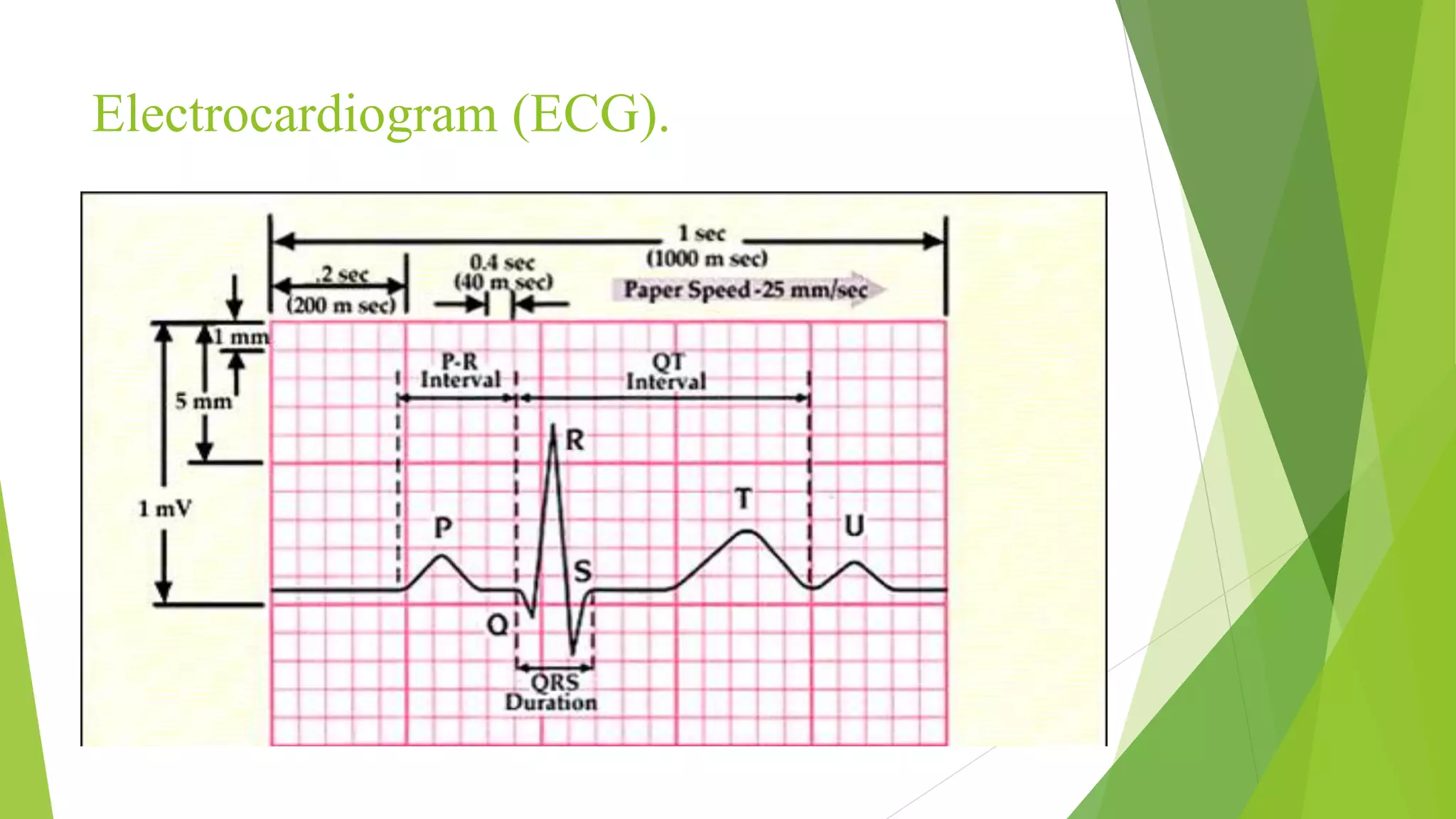 MYOCARDIAL INFARCTION | PPTX