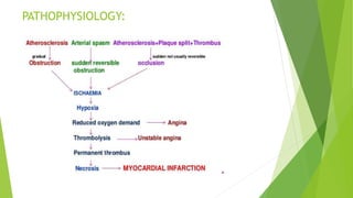 MYOCARDIAL INFARCTION | PPTX