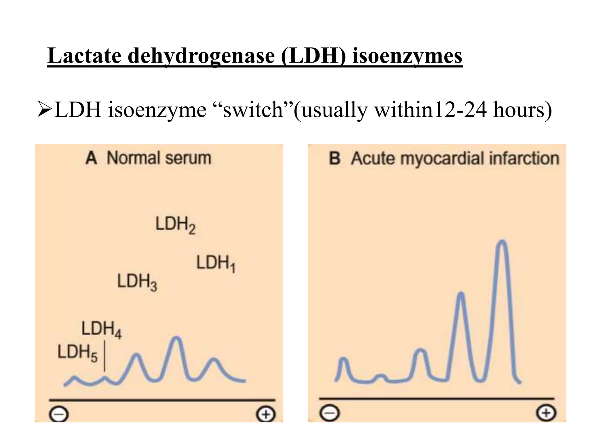 Cardiac markers in Myocardial infarction (MI) | PPTX
