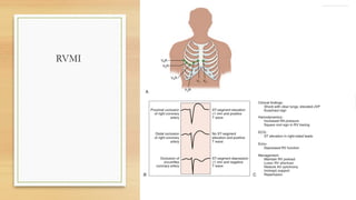 Management of myocardial infarction presentation | PPTX