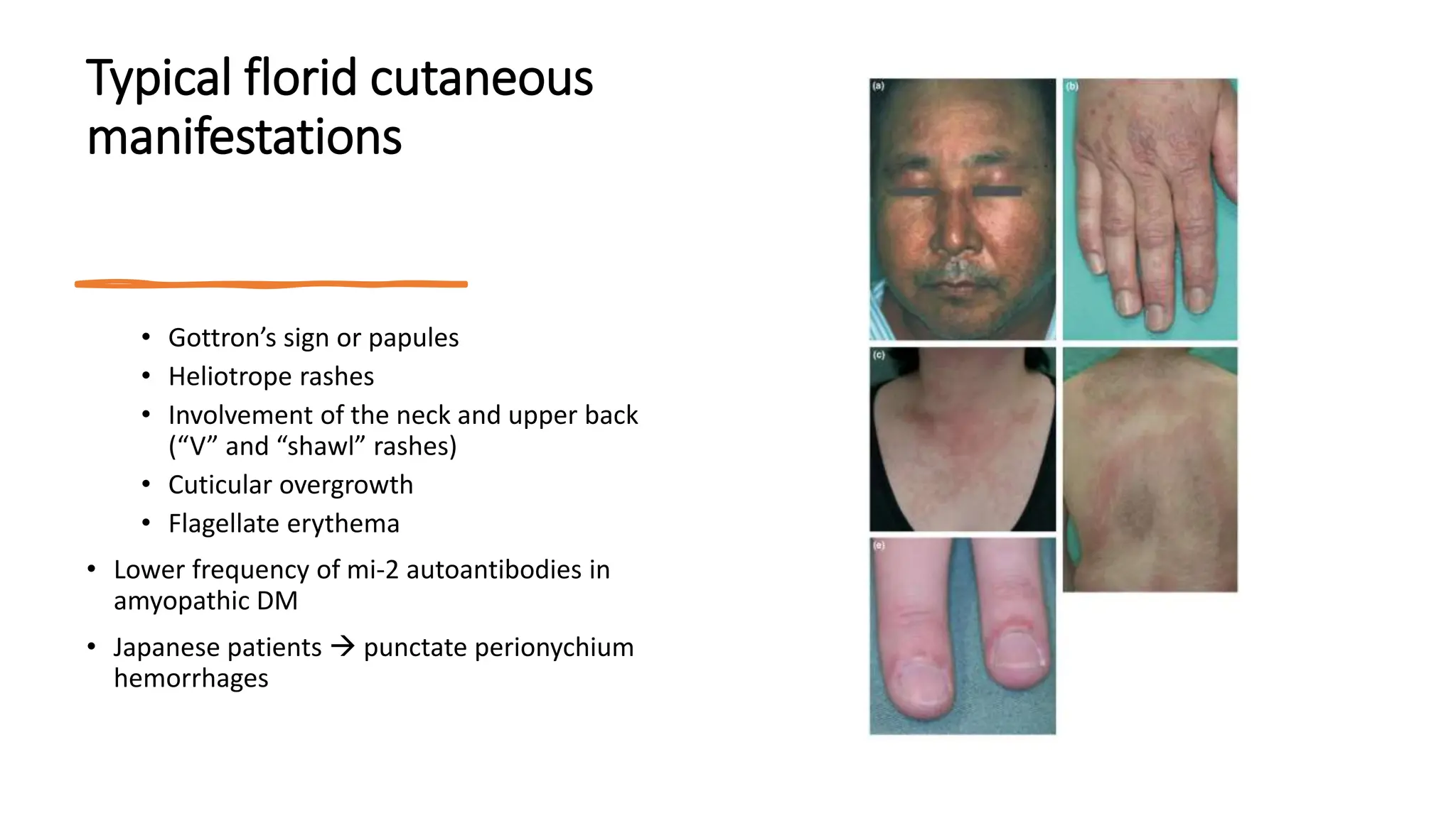 MI-2 & MDA-5.pptx sms mc Jaipur Rajasthan | PPTX