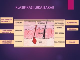 MI 5 Penatalaksanaan Pasien Akibat Luka Bakar.ppt