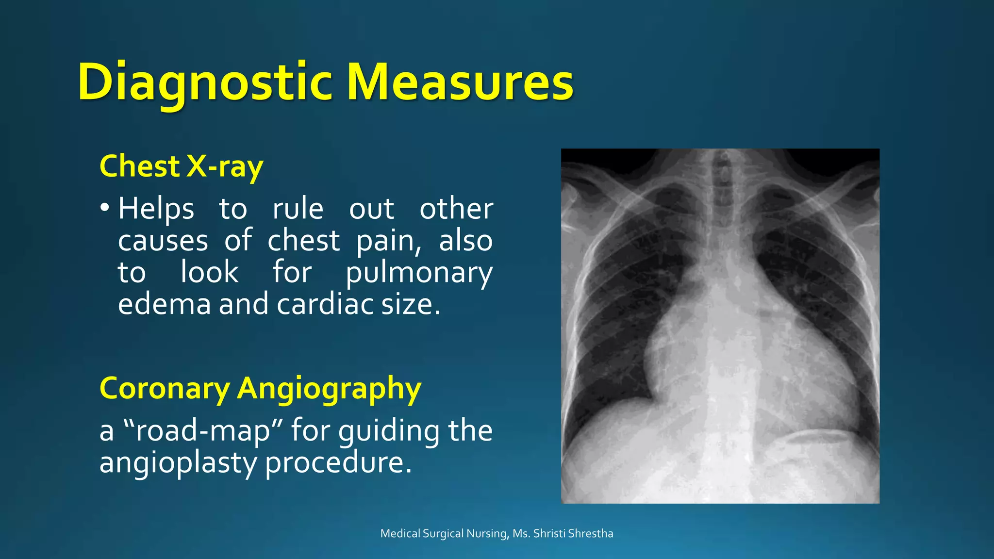 Acute Coronary Syndrome: MI | PPTX
