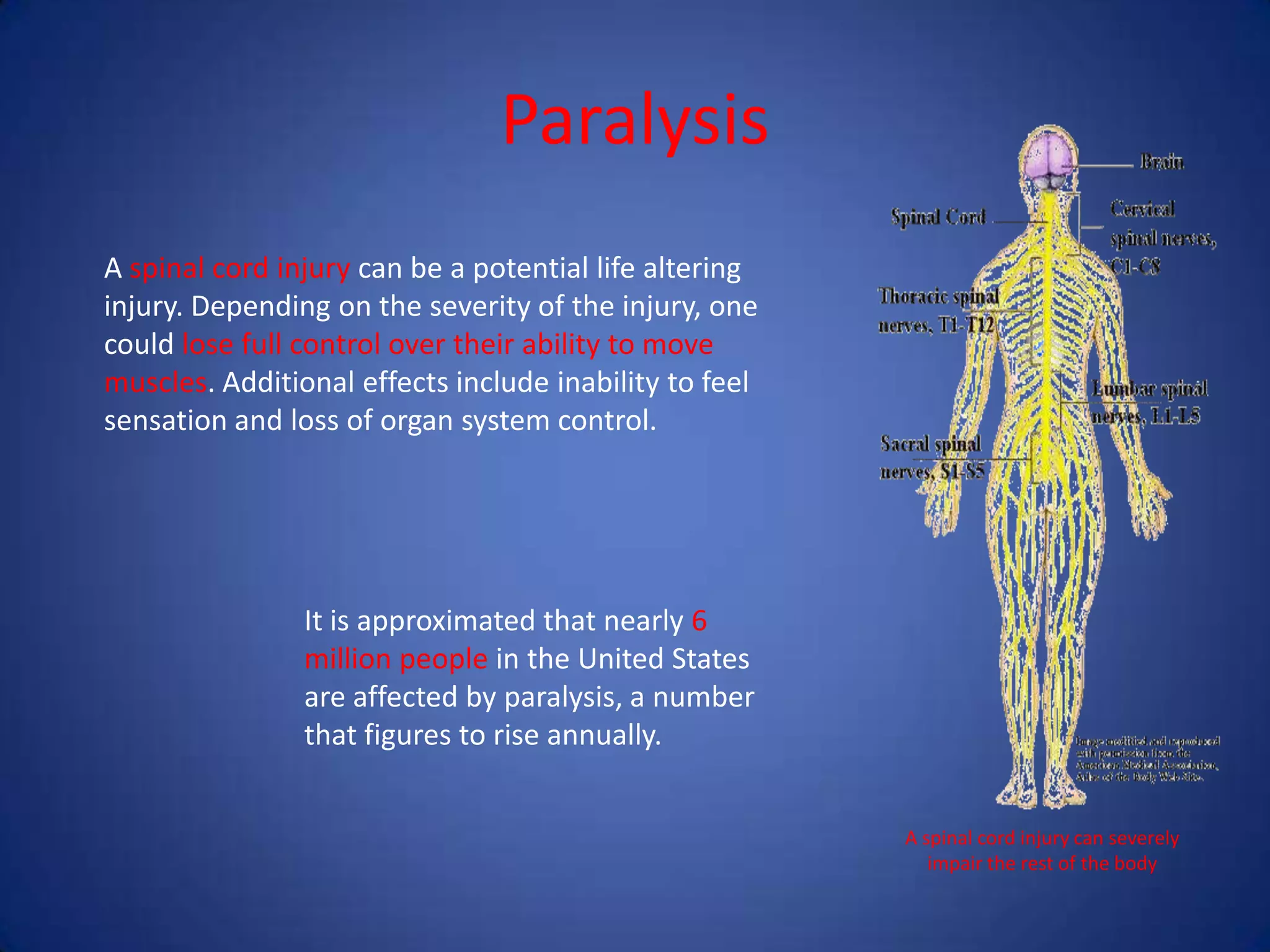 ISM3004 Miami Project to Cure Paralysis Presentation | PPT