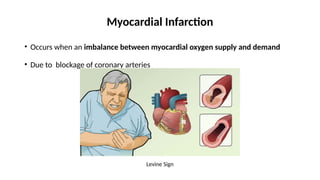 MI+Angina+Drug interactions,Myocardial Infarction | PPT