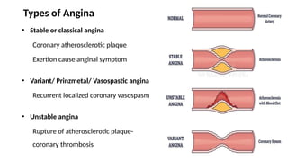 Pharmacotherapy of Angina+ myocardial infaction+ Drug interactions-1-2.pptx