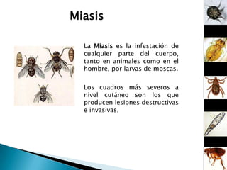 Miasis | PPTX