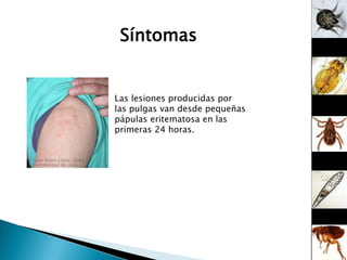 Miasis | PPTX