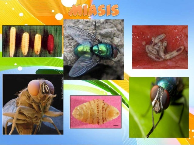 Miasis