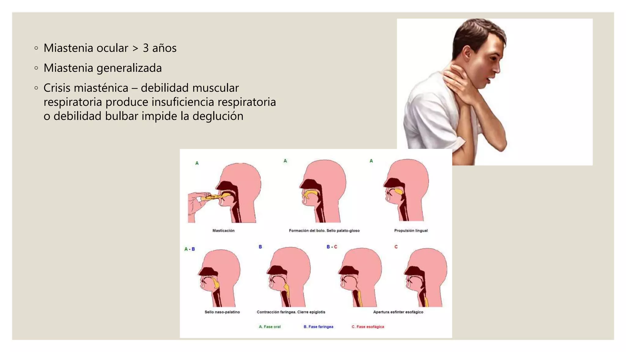 Miastenia grave | PPT