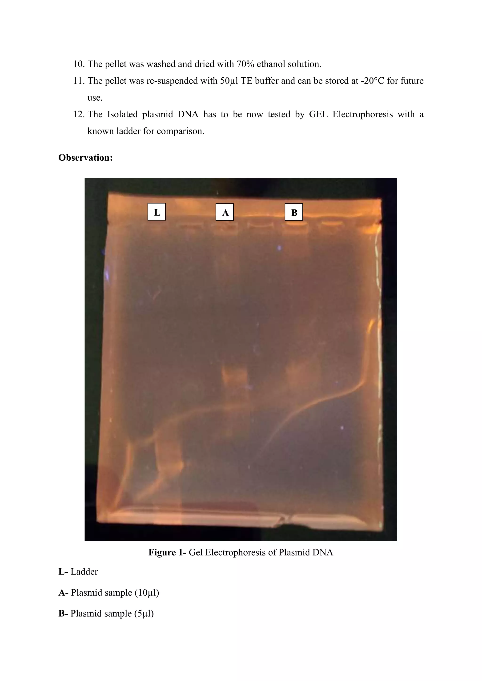 Plasmid Isolation Lab Report | DOCX
