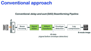 Deep Learning-Based Universal Beamformer for Ultrasound Imaging | PPT